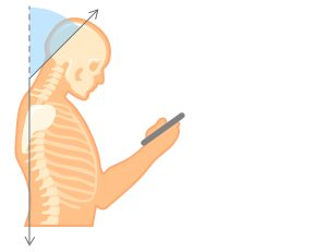 Common Types of Poor Posture | ONI Physio Fitness